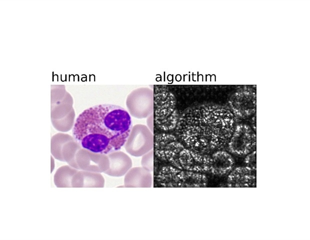 New AI-driven approach for single blood cell classification