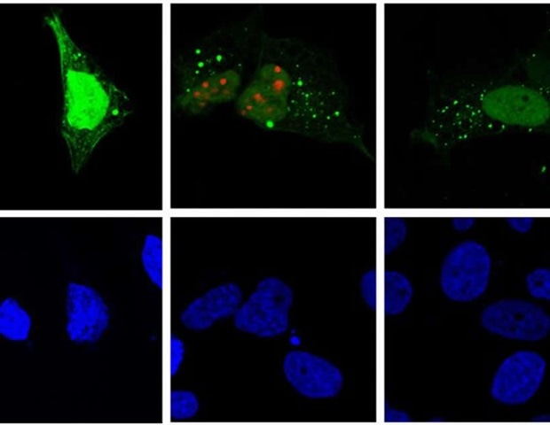 Research shows how the hepatitis D virus copies itself