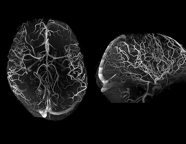 “Tic-Tac-Toe” tackles Alzheimer’s disease