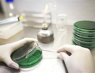 Aseptic Techniques in Microbiology