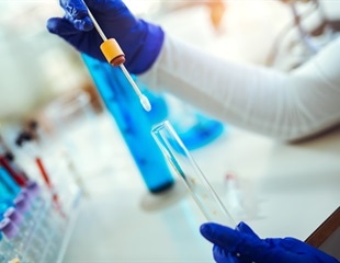 What is Microbial Forensics?