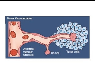 Researching Angiogenesis in Cancer