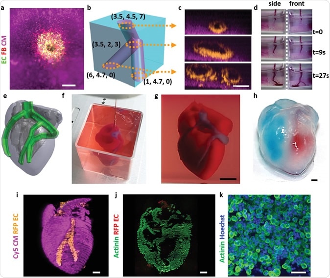 Scientists create a functioning 3D printed heart