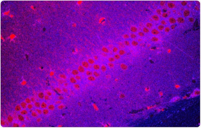 Cytoophidia Assembly, Morphology & Function