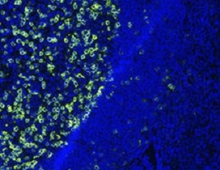 Adjuvants - Description and Types Available