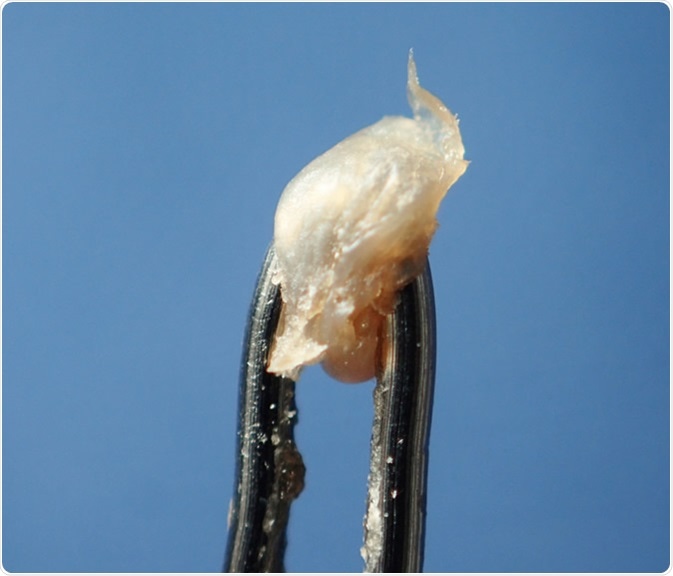What is Earwax?