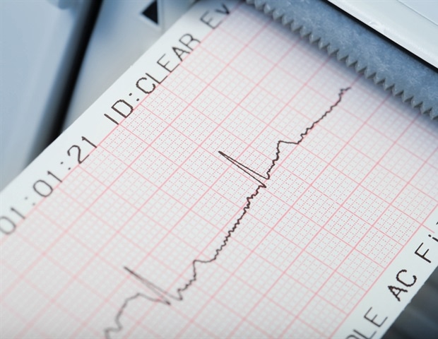 New guidelines for management of a fast heartbeat released