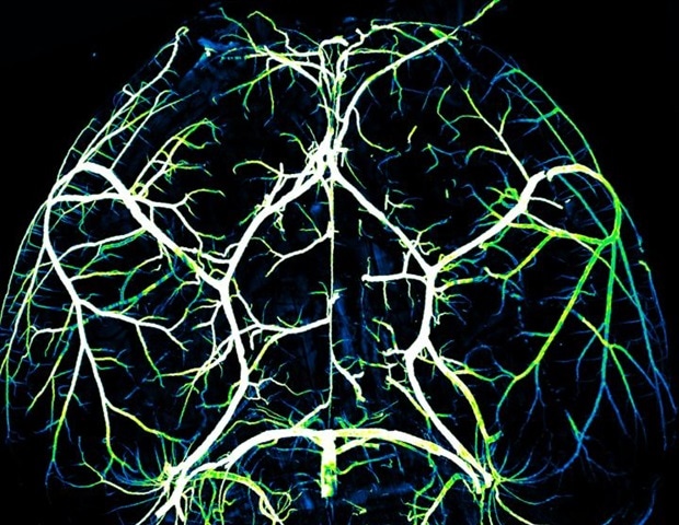 New understanding of neurovascular coupling