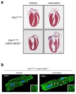 Study reveals molecular pathogenesis of muscular dystrophy-associated ...