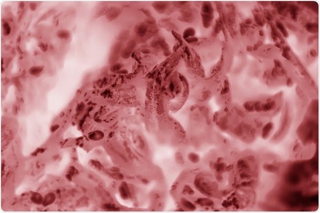 What are HeLa Cells?