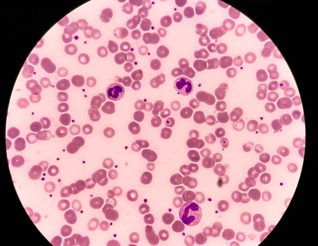 How Camomile Could Prevent Neutropenia in Pediatric Leukemia Patients