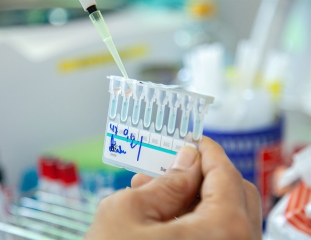 Improving Transplantation Outcomes in Positive Crossmatch Kidney ...