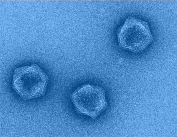 Giant viruses may possess the tools of metabolism in their genome