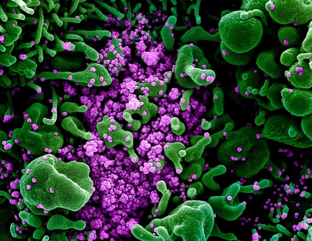 Loss of smell hints at coronavirus infection