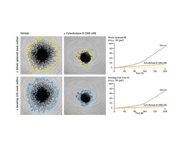 3D Tumor Spheroid Invasion Monitoring with Live-Cell Analysis