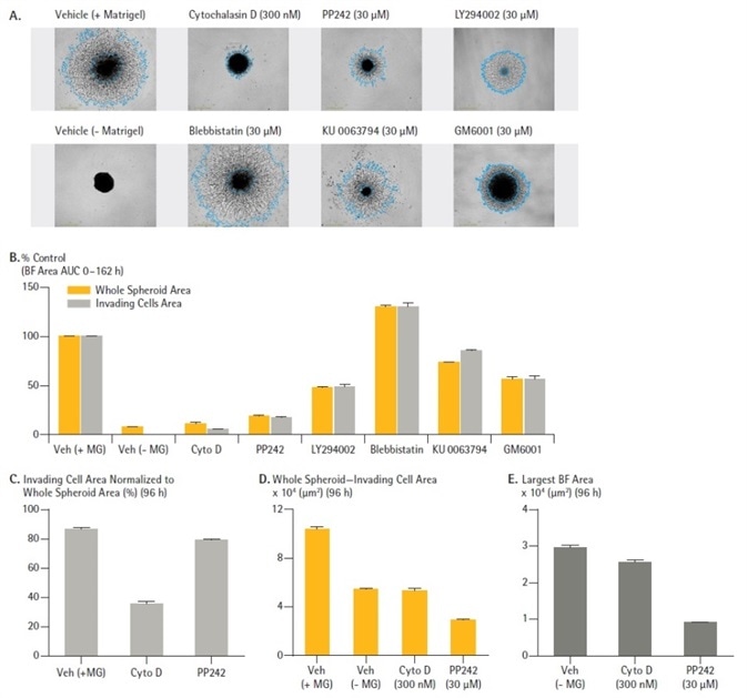 3D Tumor Spheroid Invasion Monitoring with Live-Cell Analysis