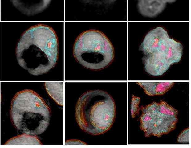 Tomocube holotomography microscopy reveals novel cholesterol membrane