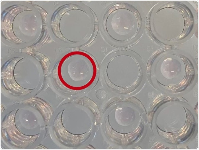 Organoid Culture Scaling with Advanced Liquid Handling
