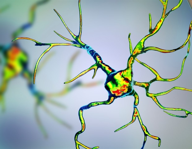 Parkinson's disease breakthrough seen in mouse model