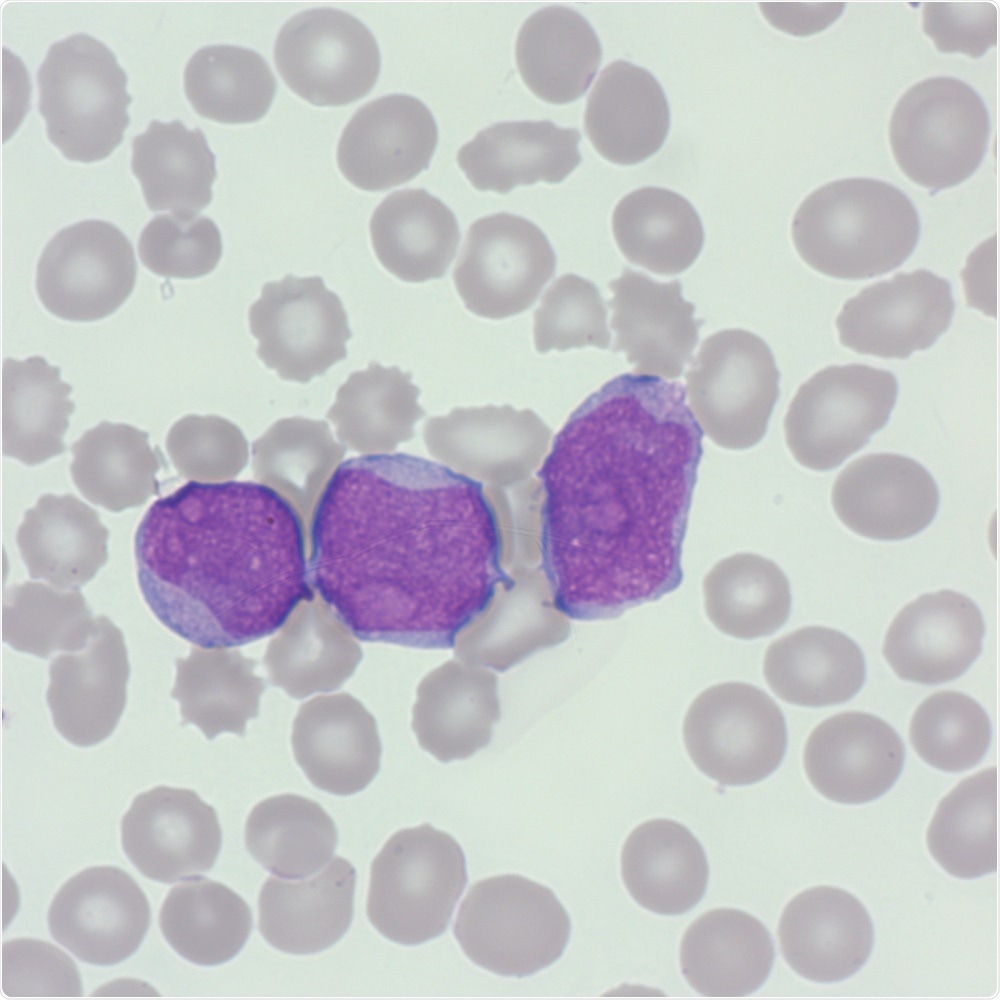 HORIBA Medical launches digital blood cell morphology QC tool