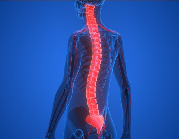What is Autonomic Dysreflexia?