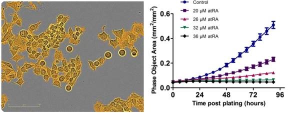 Quantitative Measurement of Cancer Cell Proliferation Using CellPlayer ...